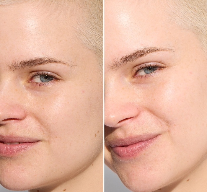 VinoHydra: The hydrating solution for sensitive skin | CAUDALIE®